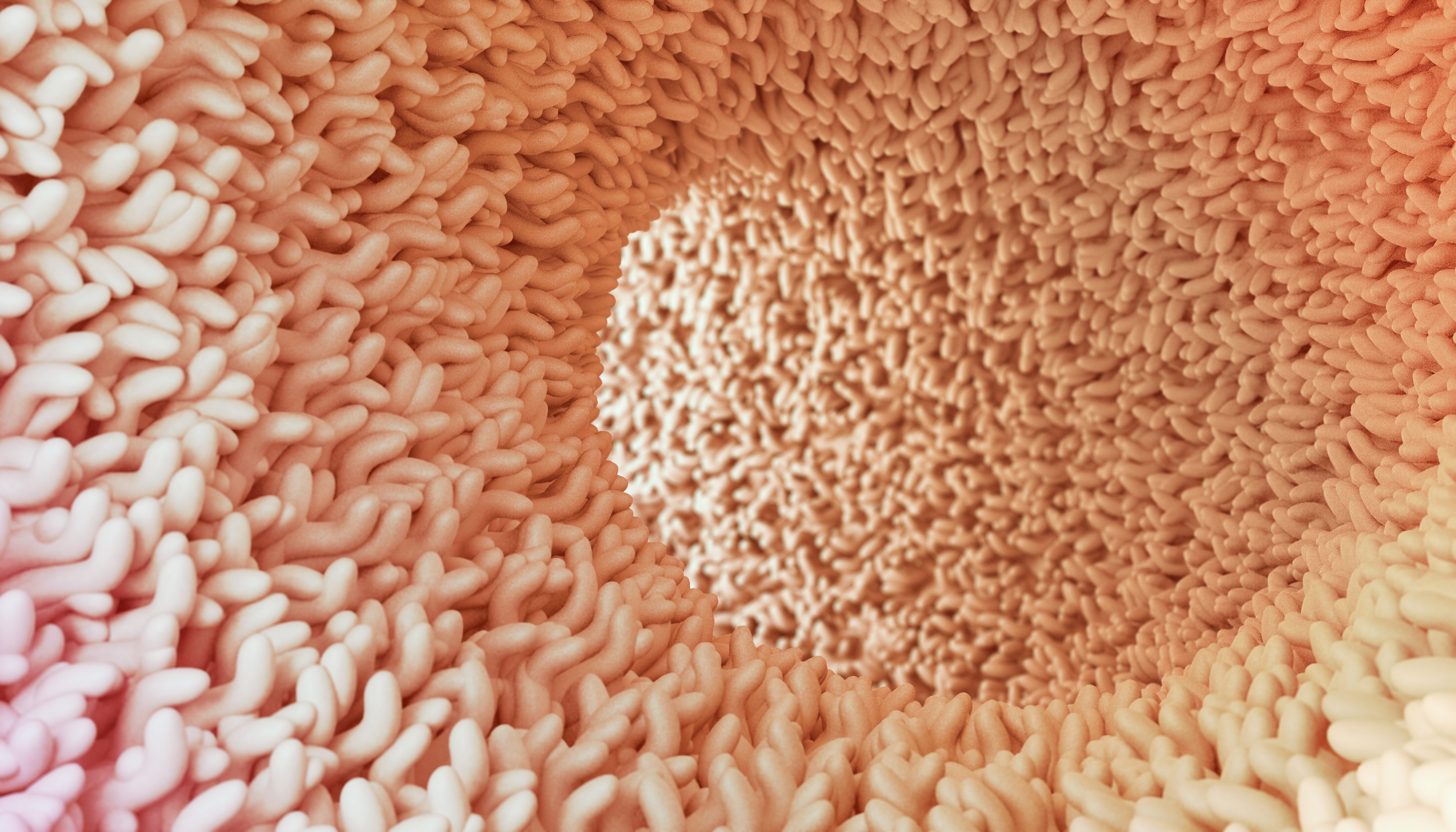 Polipi intestinali: i sintomi, le cause e la cura