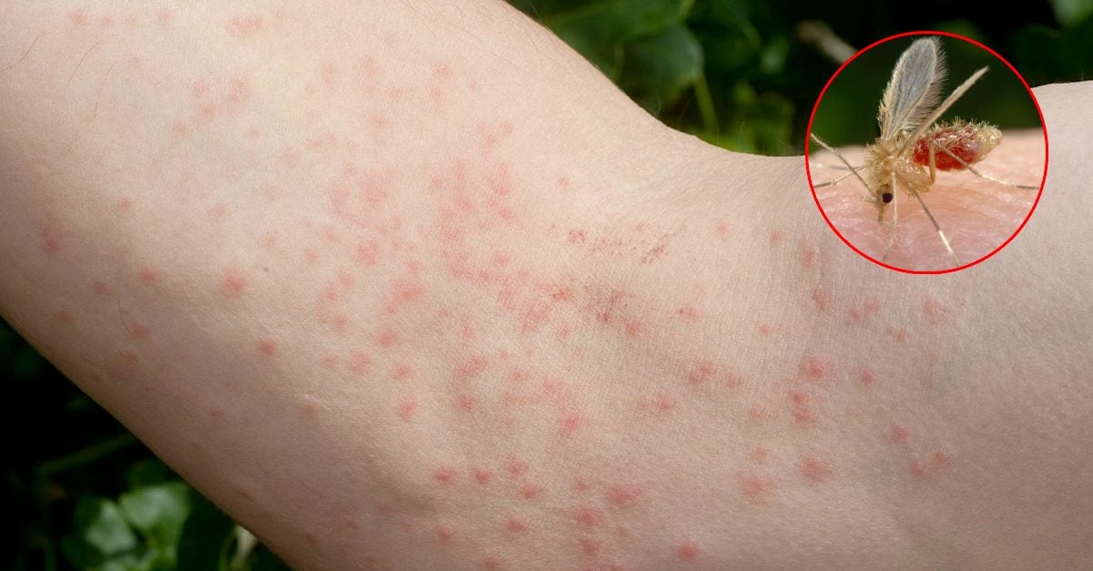 Pappataci: cosa sono e come difendersi | Ohga!