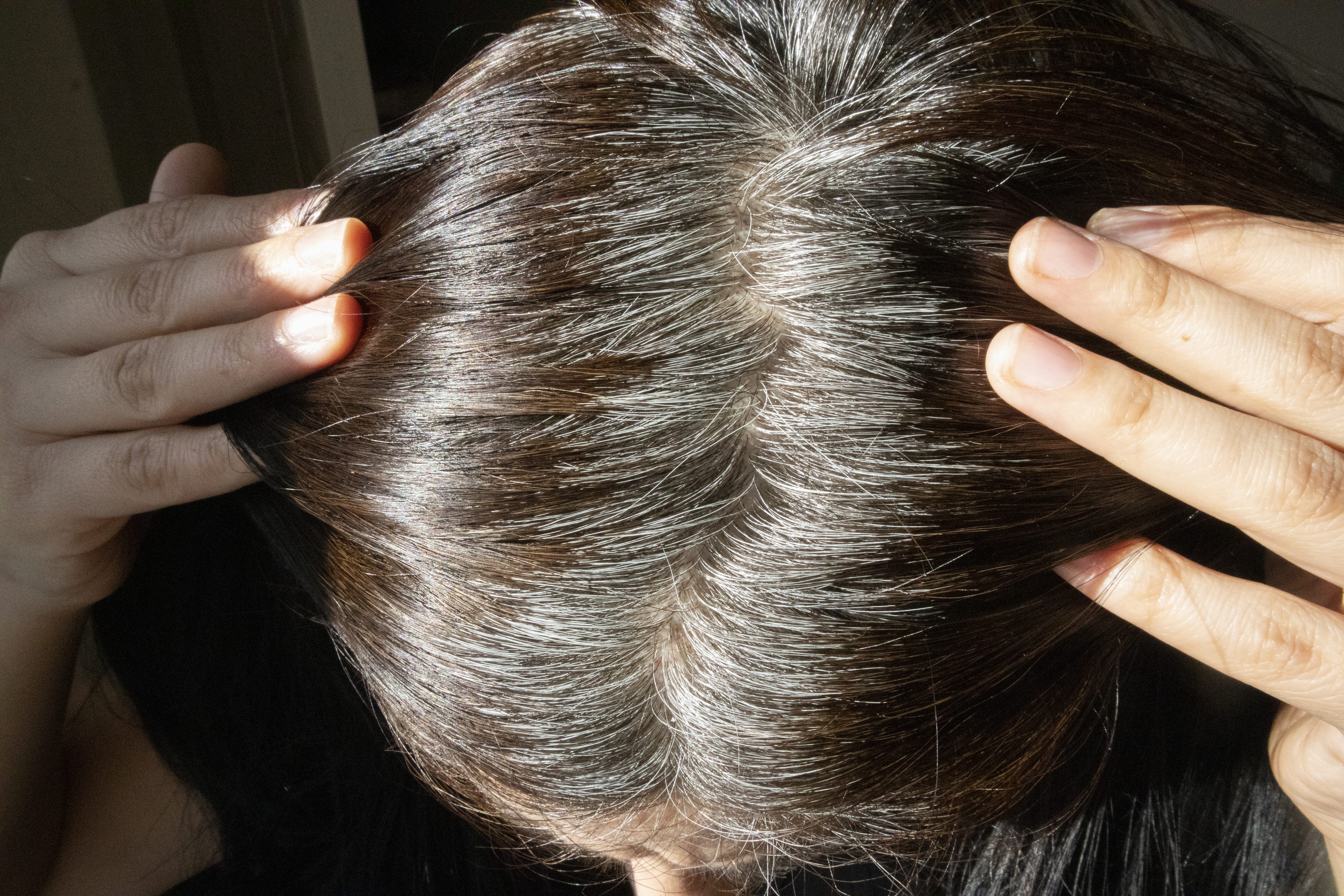 I capelli grigi possono tornare al colore naturale? Identificata la ...